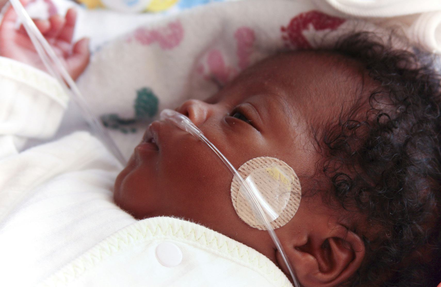 11 Problems Premature Babies May Face Later In Life