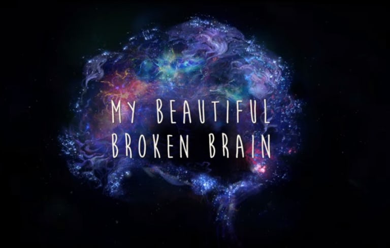 David Lynch's Documentary 'My Beautiful Broken Brain' Is Coming To ...