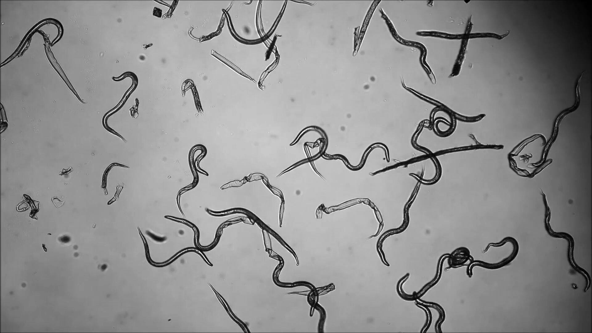 There’s A Worm That Sheds Its Skin To Invade Your Body & It’s The ...